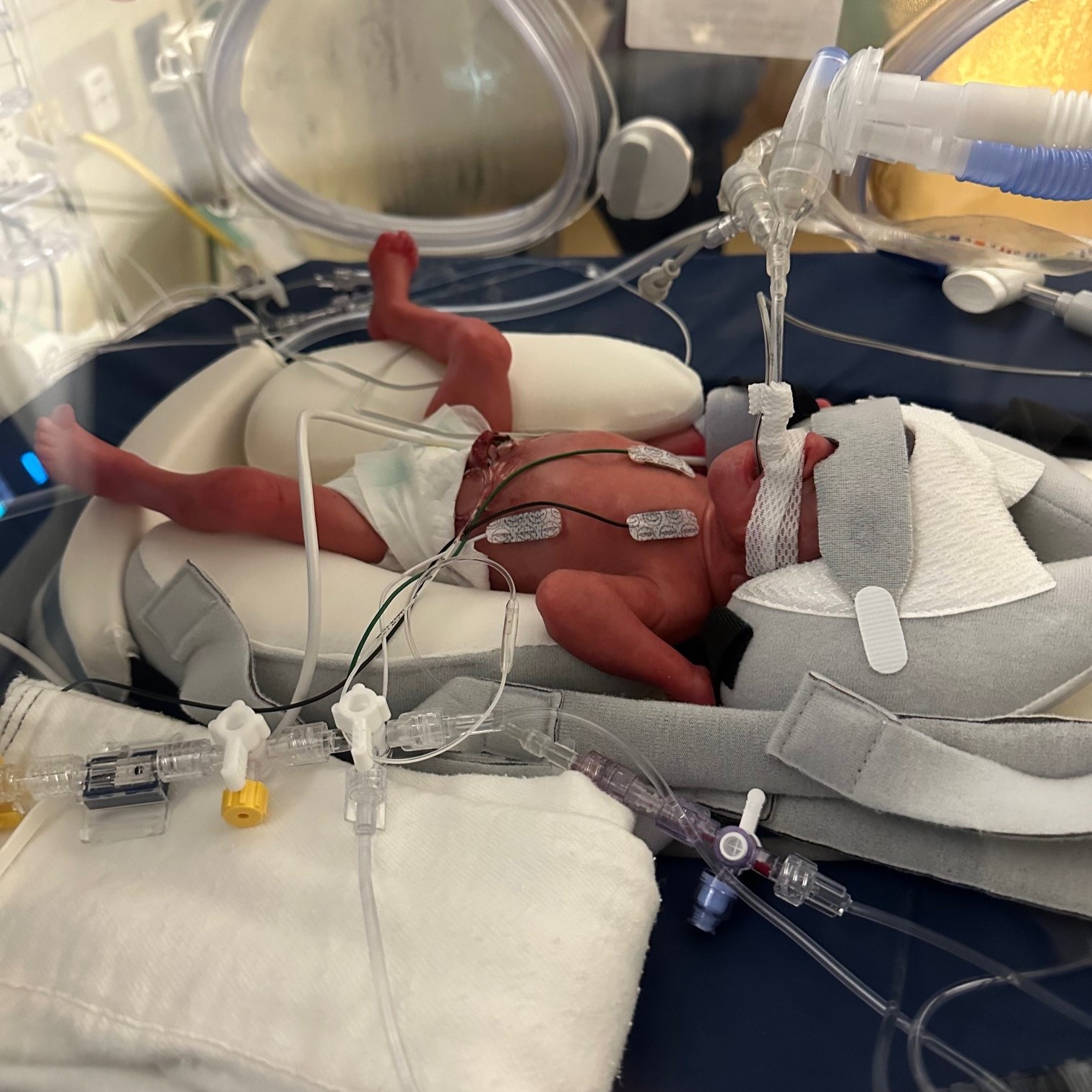 How the Ronald McDonald House Became a Lifeline for the Hurley Family ...